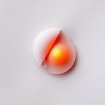 Adhesive Capsulitis Capsular Pattern